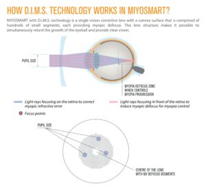 MiyoSmart Lenses - Eyewear Central